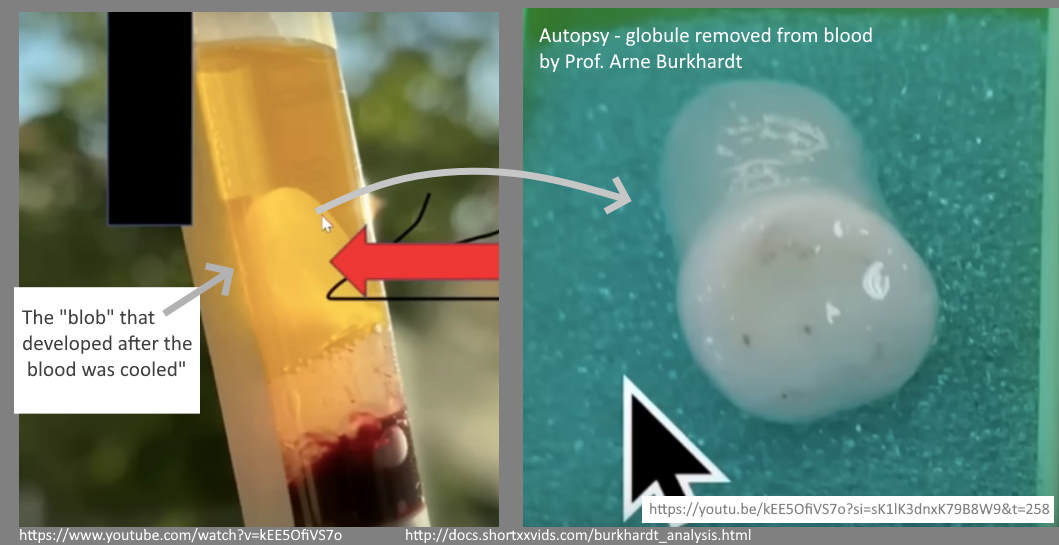 Embalmers are finding unusual clots | Totality of Evidence